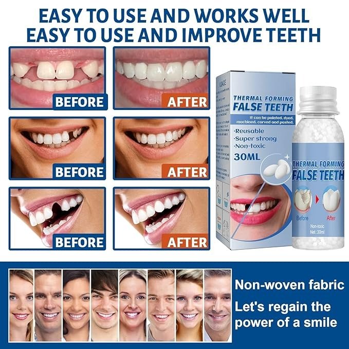 RESINA DENTAL MOLDEABLE – morewellness